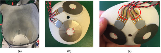 Prosthesis | Free Full-Text | An Instrumented Printed Insert for ...