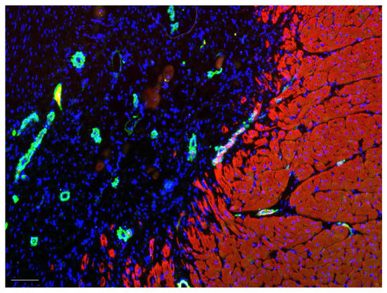 Prosthesis | Free Full-Text | Decellularized Porcine Pericardium ...