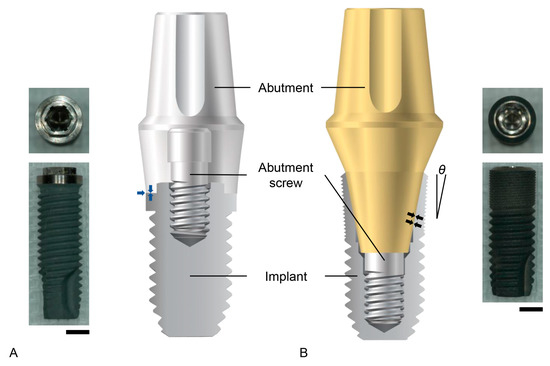 Influence of Implant–Abutment Connection Biomechanics on Biological Response: A Literature ...