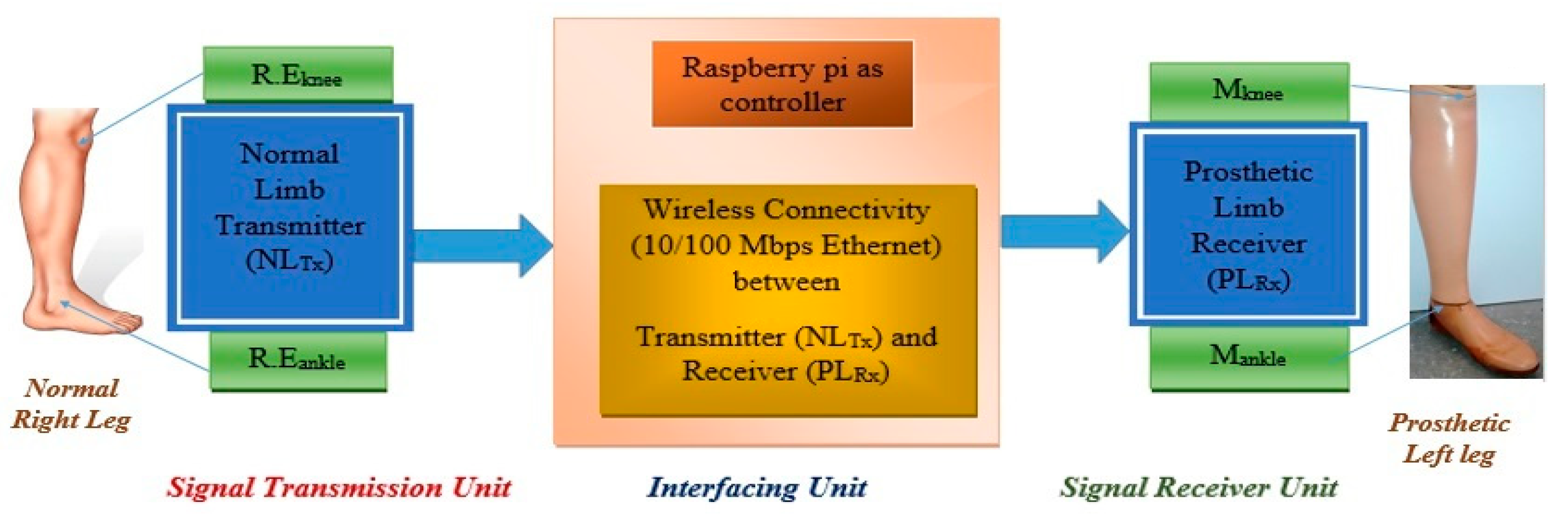 Design Analysis of Prosthetic Unilateral Transtibial Lower Limb with Gait Coordination
