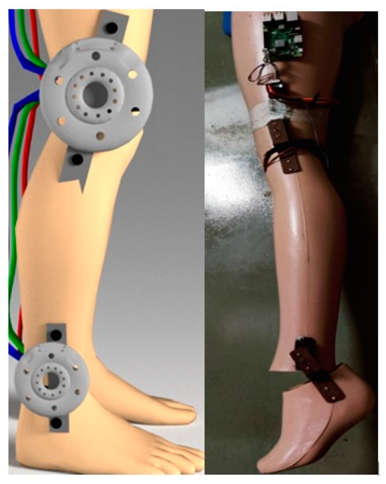 Prosthesis Free Full Text Design Analysis Of Prosthetic Unilateral