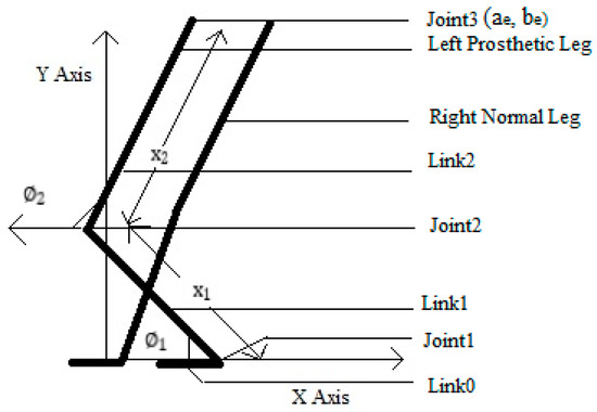 Design Analysis of Prosthetic Unilateral Transtibial Lower Limb with ...