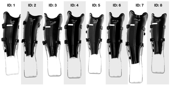 Biomechanical Analysis of Recreational Cycling with Unilateral ...