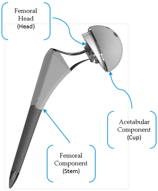 Is It Possible to Create an “Ideal Endoprosthesis” for an “Ideal Total ...