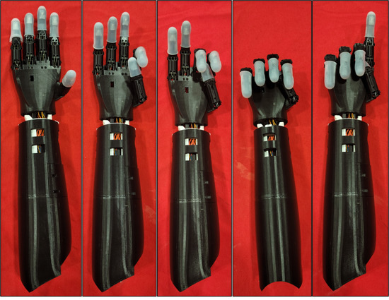 Prosthesis | Free Full-Text | Controlling a Below-the-Elbow Prosthetic ...