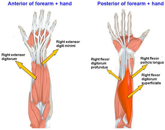 Myo Transformer Signal Classification for an Anthropomorphic Robotic Hand