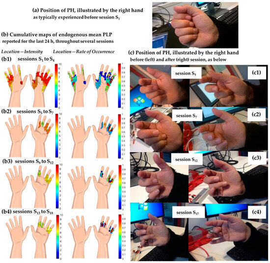Non-Invasive Sensory Input Results in Changes in Non-Painful and ...