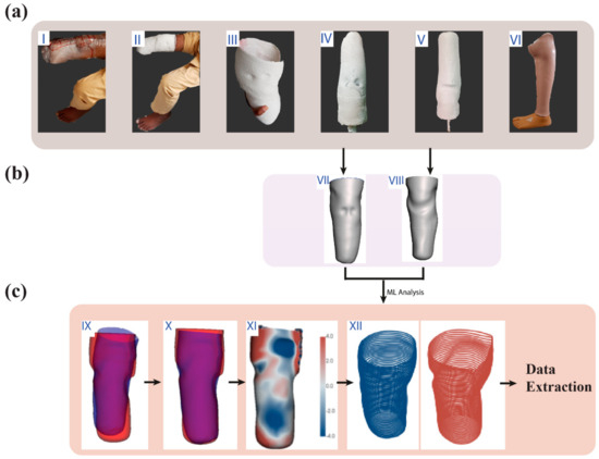 Shape Analysis of Prosthetic Socket Rectification Procedure for Transtibial Amputees