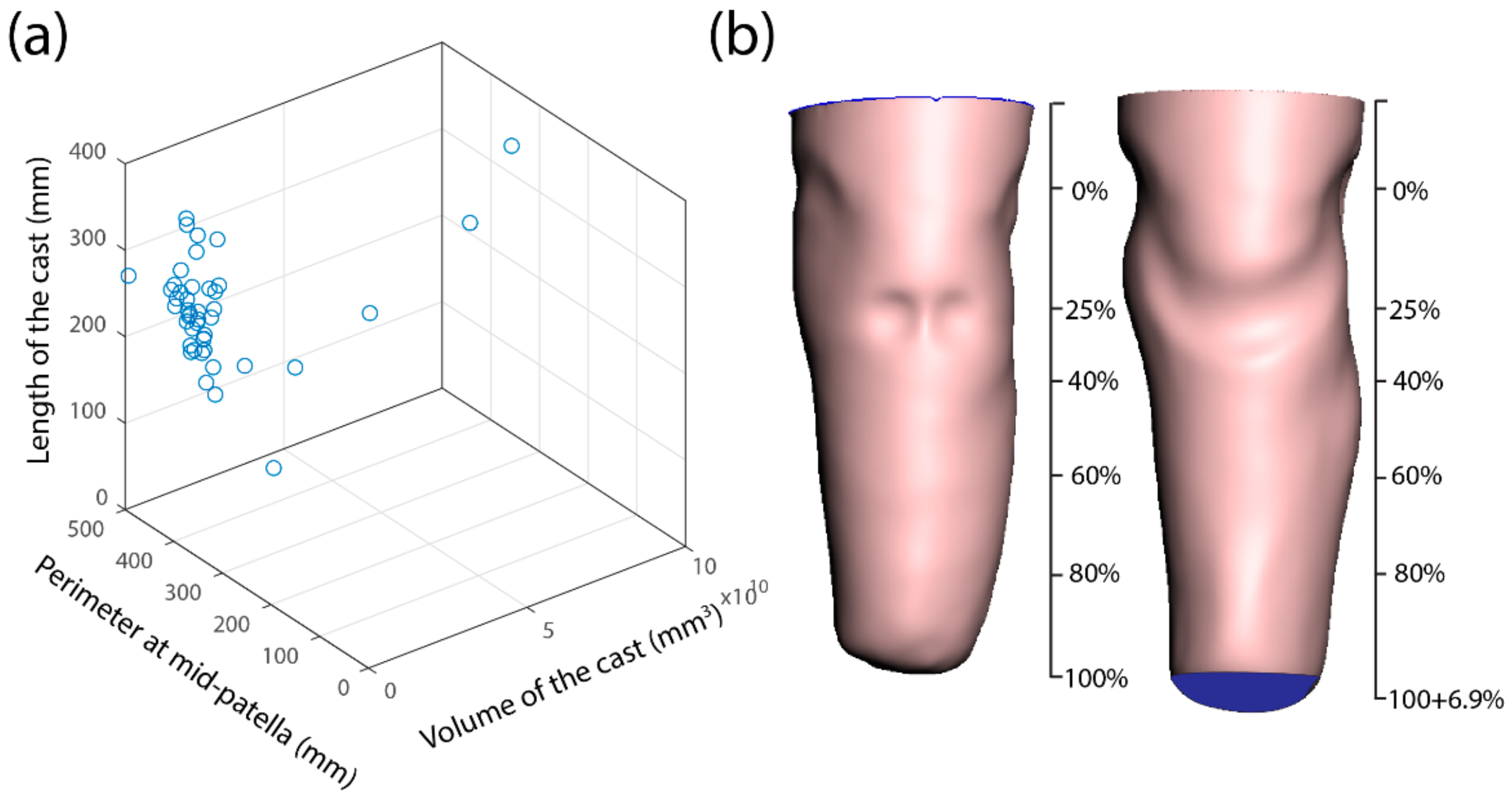 Shape Analysis of Prosthetic Socket Rectification Procedure for Transtibial Amputees