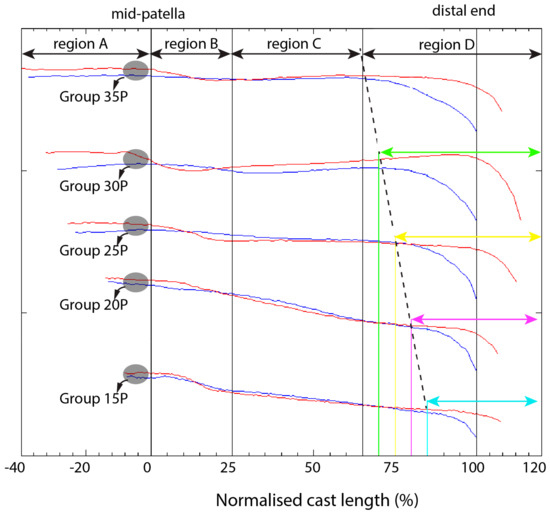 Shape Analysis of Prosthetic Socket Rectification Procedure for ...
