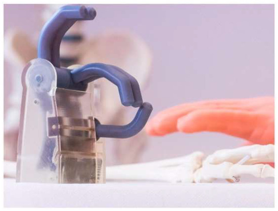 Reconstructing the First “Iron Hand” of Knight Götz von Berlichingen ...