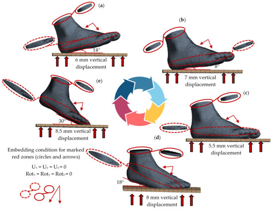 Numerical Analysis of the Plantar Pressure Points during the Stance ...