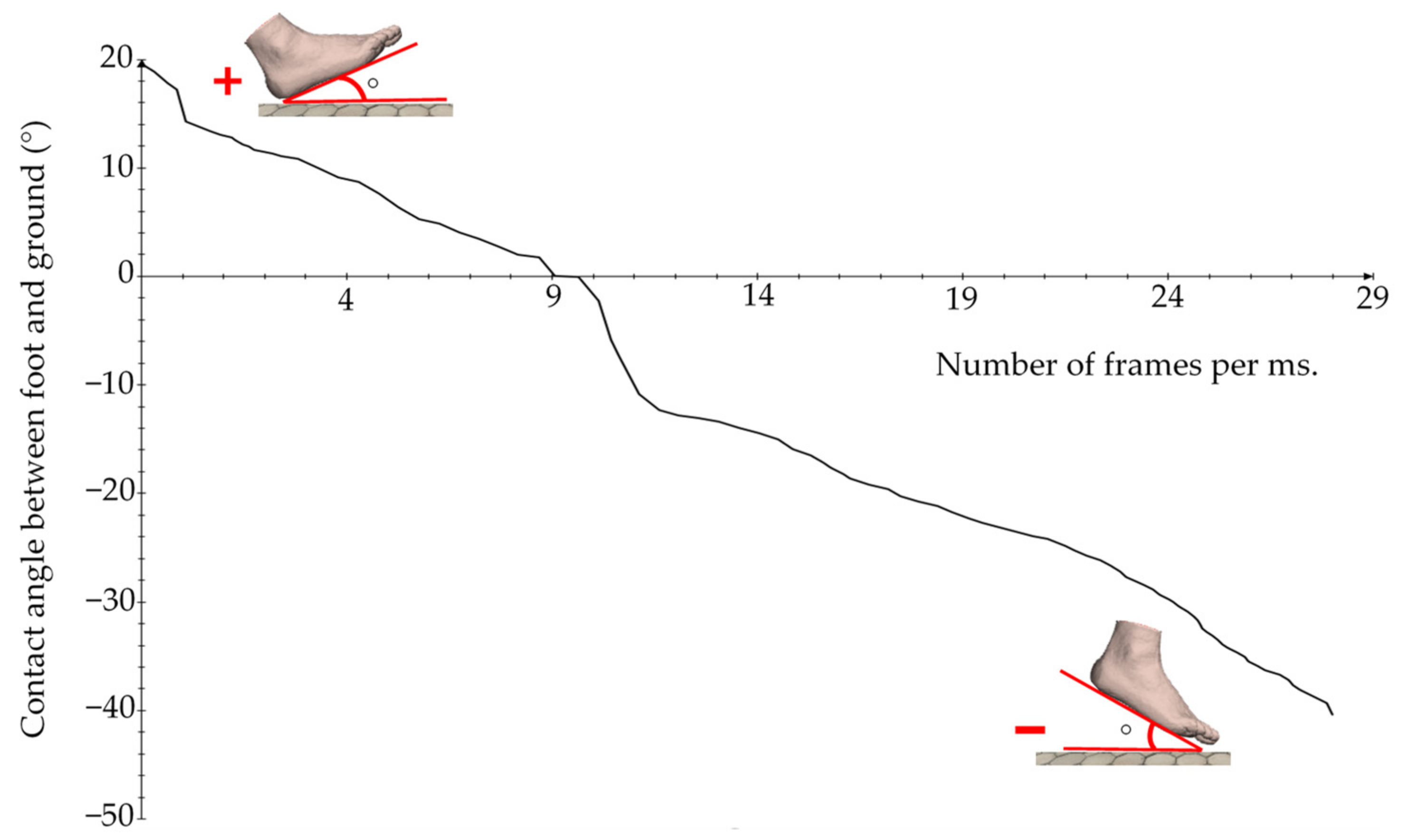 Numerical Analysis of the Plantar Pressure Points during the Stance ...