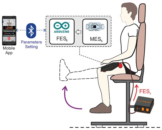 MES-FES Interface Enhances Quadriceps Muscle Response in Sitting ...