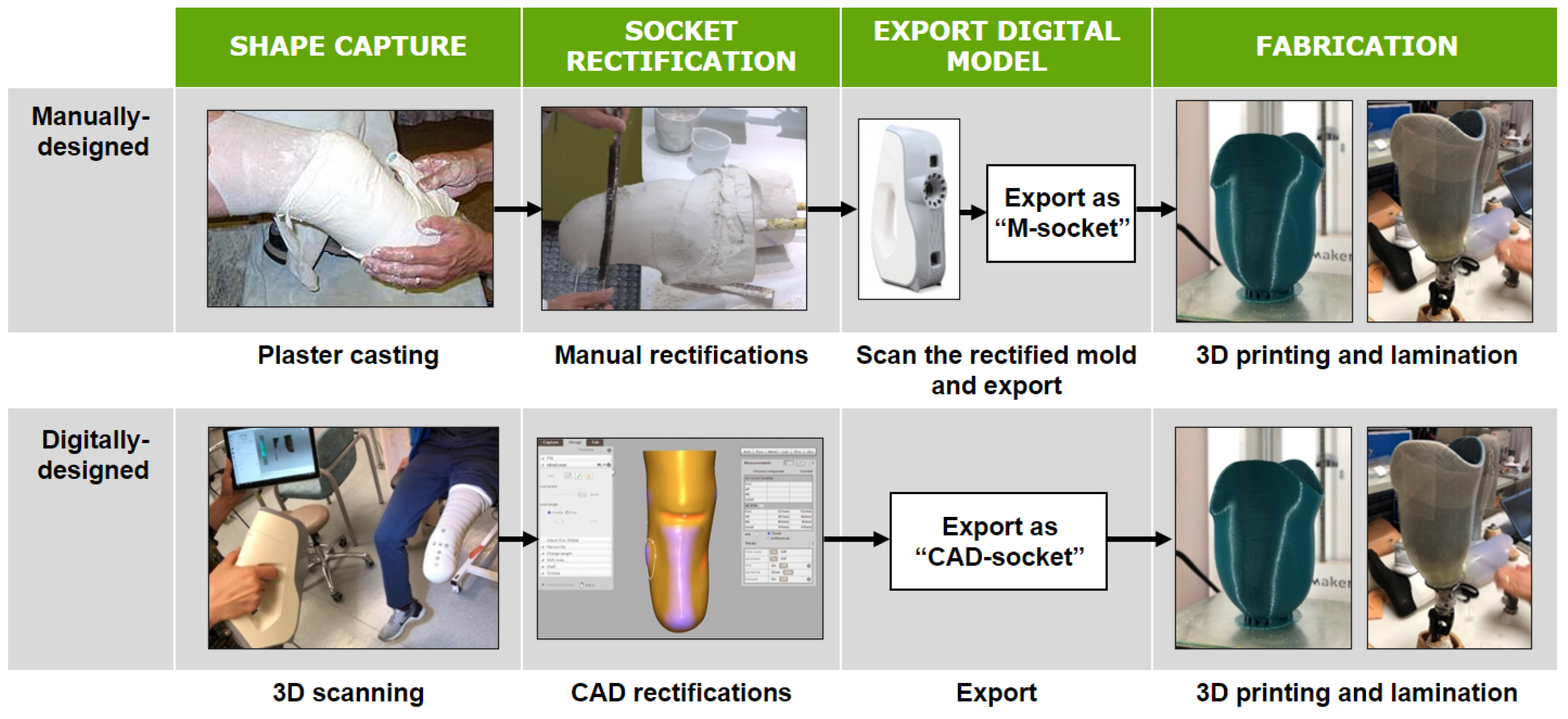 Comparison of Socket Geometry, Socket Comfort, and Patient Experience ...