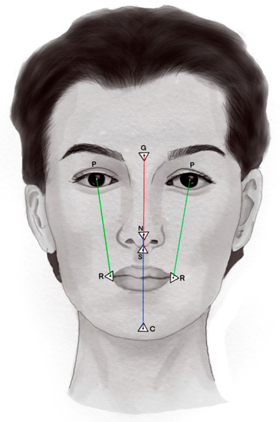 Evaluation of Various Facial Measurements as an Adjunct in Determining ...