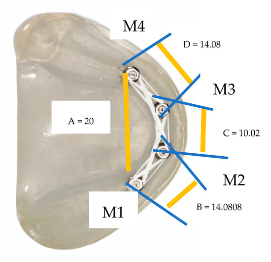 An In Vitro Study on the Accuracy of a Splint for the Transfer of ...