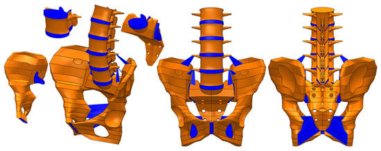 Biomechanical Analysis of Stress–Strain Distribution in the Lumbar ...