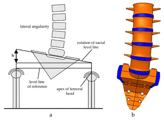 Biomechanical Analysis of Stress–Strain Distribution in the Lumbar ...
