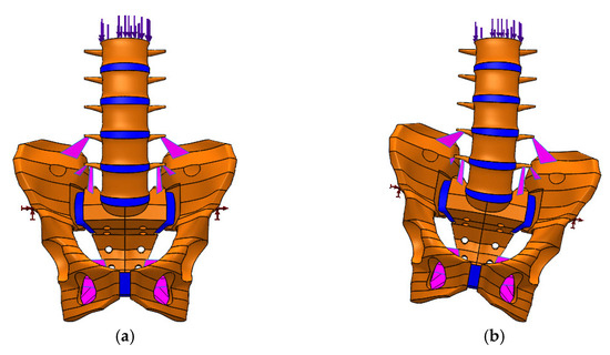 Biomechanical Analysis of Stress–Strain Distribution in the Lumbar ...