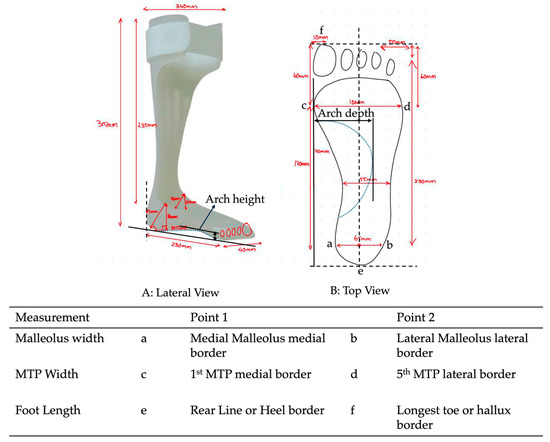 User-Centered Design Framework for Personalized Ankle–Foot Orthoses