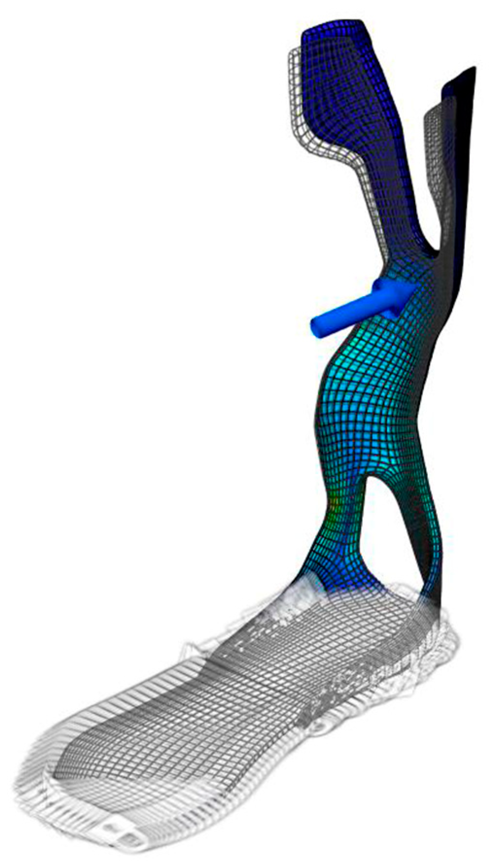User-Centered Design Framework for Personalized Ankle–Foot Orthoses