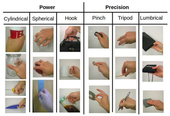 Shaping the Future of Upper Extremity Prostheses Through 3D Printing