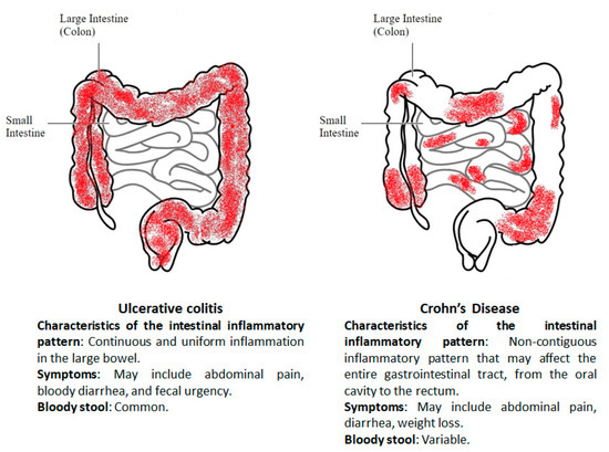 New Insights into Inflammatory Bowel Diseases from Proteomic and ...