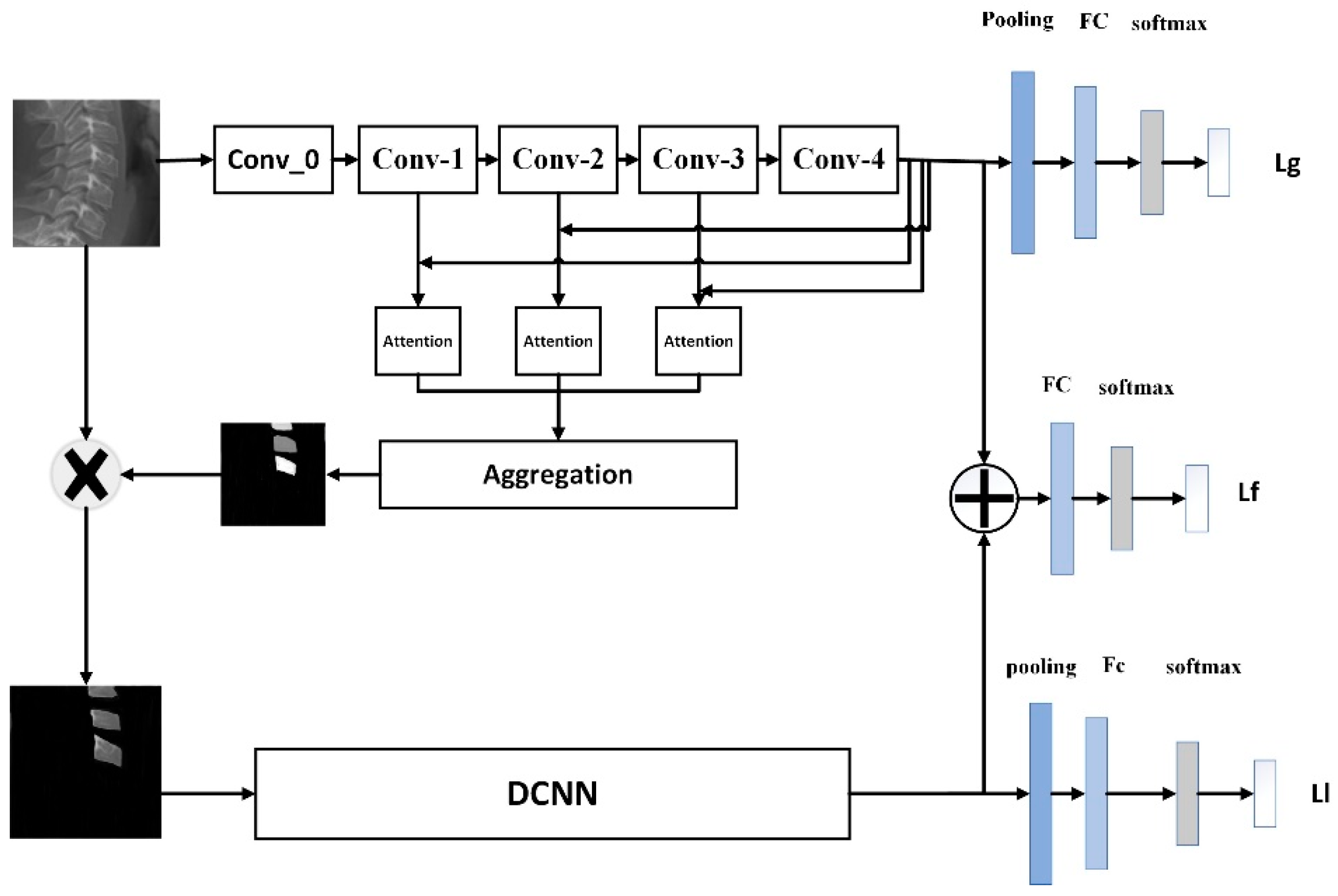 Attention-Guided Multi-Scale CNN Network for Cervical Vertebral ...