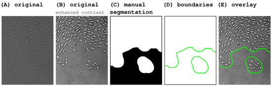 Knowledge-Based Image Analysis: Bayesian Evidences Enable the Comparison of Different Image ...