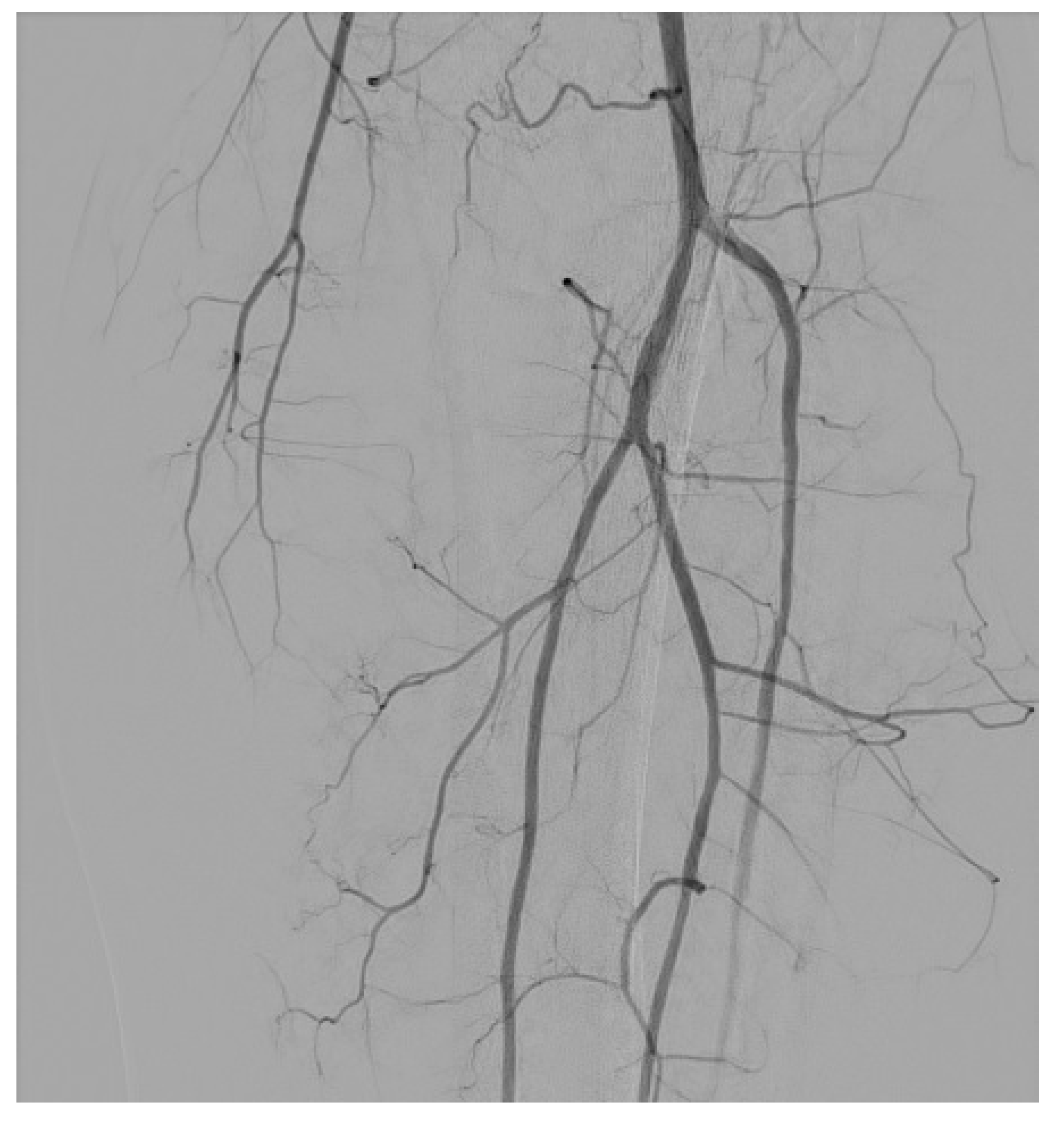 Radiation Free Full Text Digital Subtraction Angiography Dsa Technical And Diagnostic