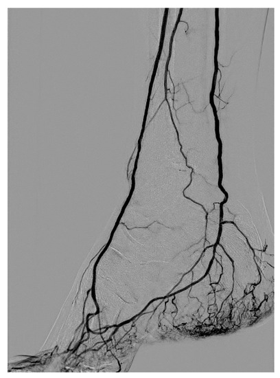 Digital Subtraction Angiography (DSA) Technical and Diagnostic Aspects ...