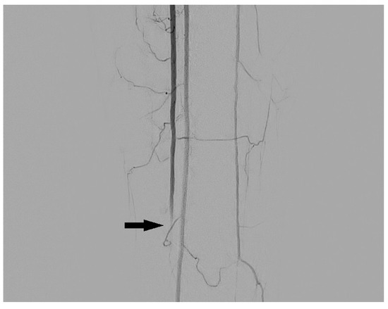 Digital Subtraction Angiography (DSA) Technical and Diagnostic Aspects ...