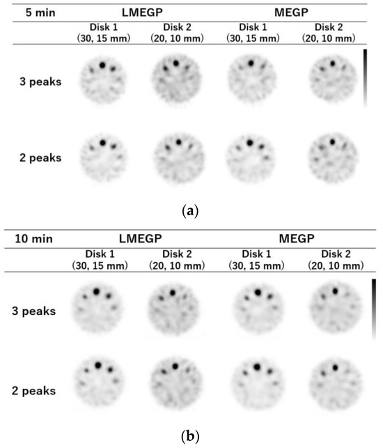 Acquisition Conditions for Lu-177 DOTATATE Imaging