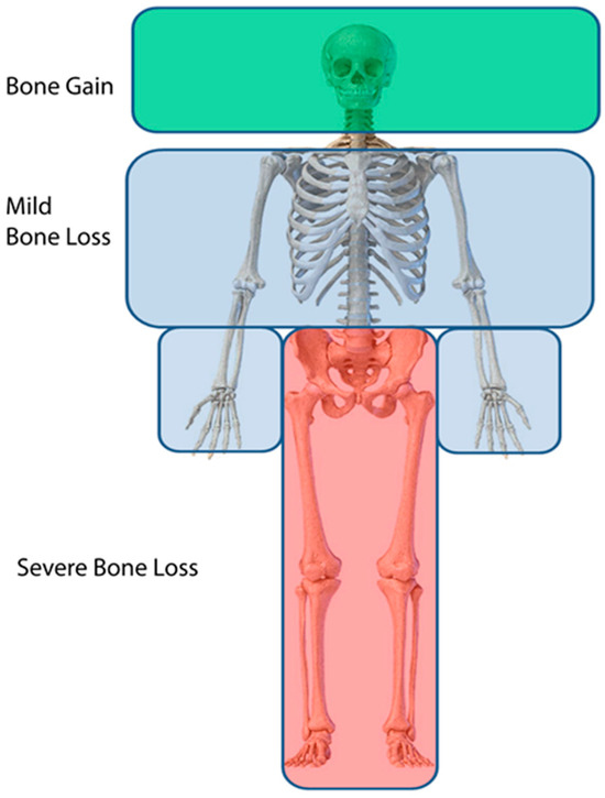 Receptors | Free Full-Text | Receptors Implicated in Microgravity-Induced Bone Loss