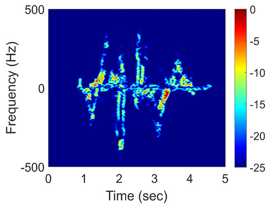 Arm Motion Classification Using Time-Series Analysis of the Spectrogram ...