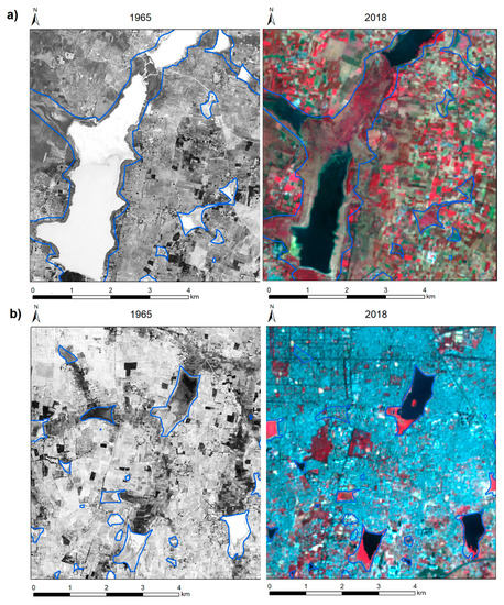 Spatial and Temporal Dynamics of Urban Wetlands in an Indian Megacity ...