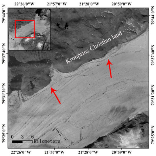 Basal Channel Extraction and Variation Analysis of ...