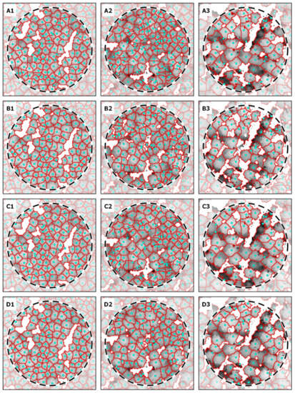 Parameterization of the Individual Tree Detection Method Using Large Dataset from Ground Sample ...