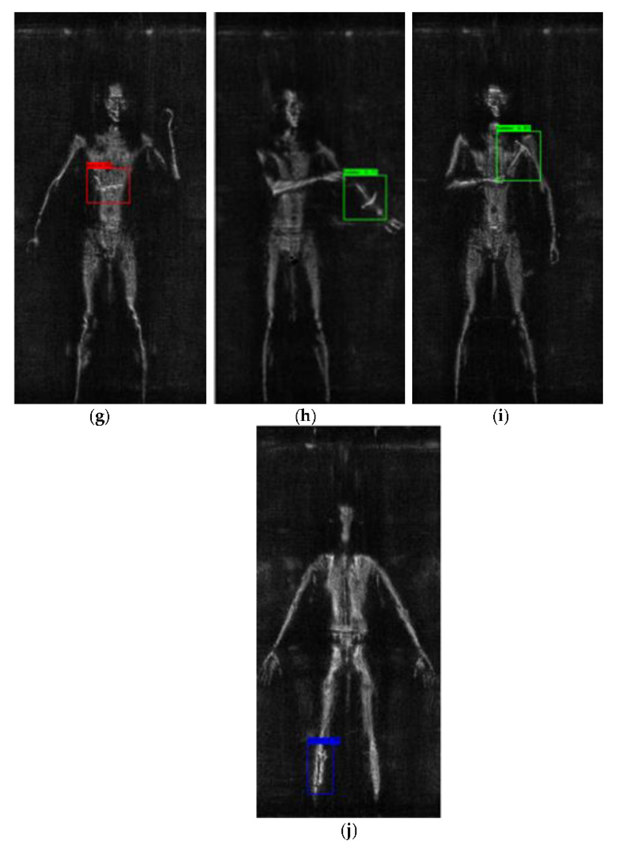 A Suspicious Multi Object Detection And Recognition Method For Millimeter Wave Sar Security