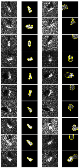 LIME-Based Data Selection Method for SAR Images Generation Using GAN