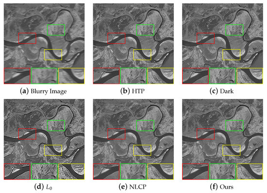Blind Remote Sensing Image Deblurring Using Local Binary Pattern Prior