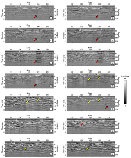 Fast Segmentation and Dynamic Monitoring of Time-Lapse 3D GPR Data Based on U-Net
