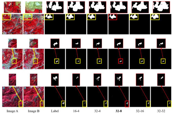DSNUNet: An Improved Forest Change Detection Network by Combining Sentinel-1 and Sentinel-2 Images