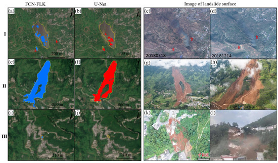 Deep Learning Method of Landslide Inventory Map with Imbalanced Samples ...