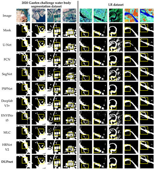 DUPnet: Water Body Segmentation with Dense Block and Multi-Scale Spatial Pyramid Pooling for ...
