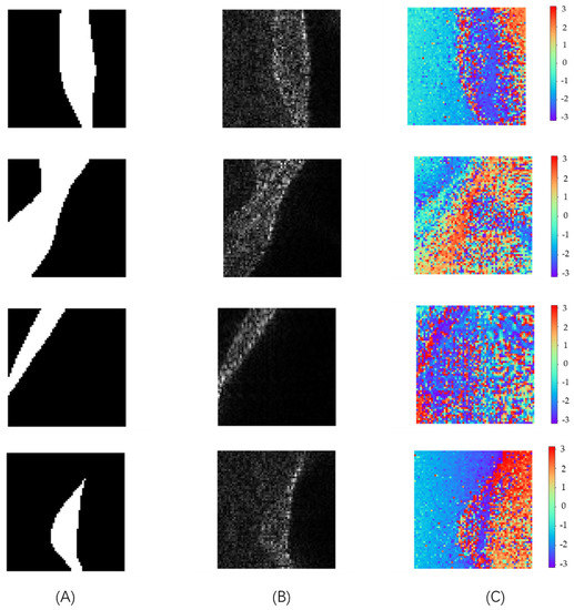 Remote Sensing | Free Full-Text | Layover Detection Using Neural Network Based on Expert Knowledge