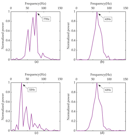 Supervirtual Refraction Interferometry in the Radon Domain