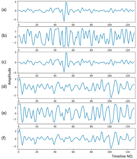 Fault Detection via 2.5D Transformer U-Net with Seismic Data Pre-Processing
