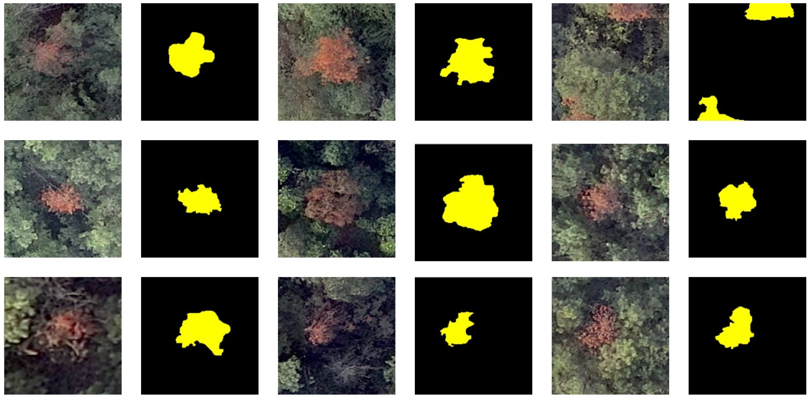 Recognition of Abnormal Individuals Based on Lightweight Deep Learning ...